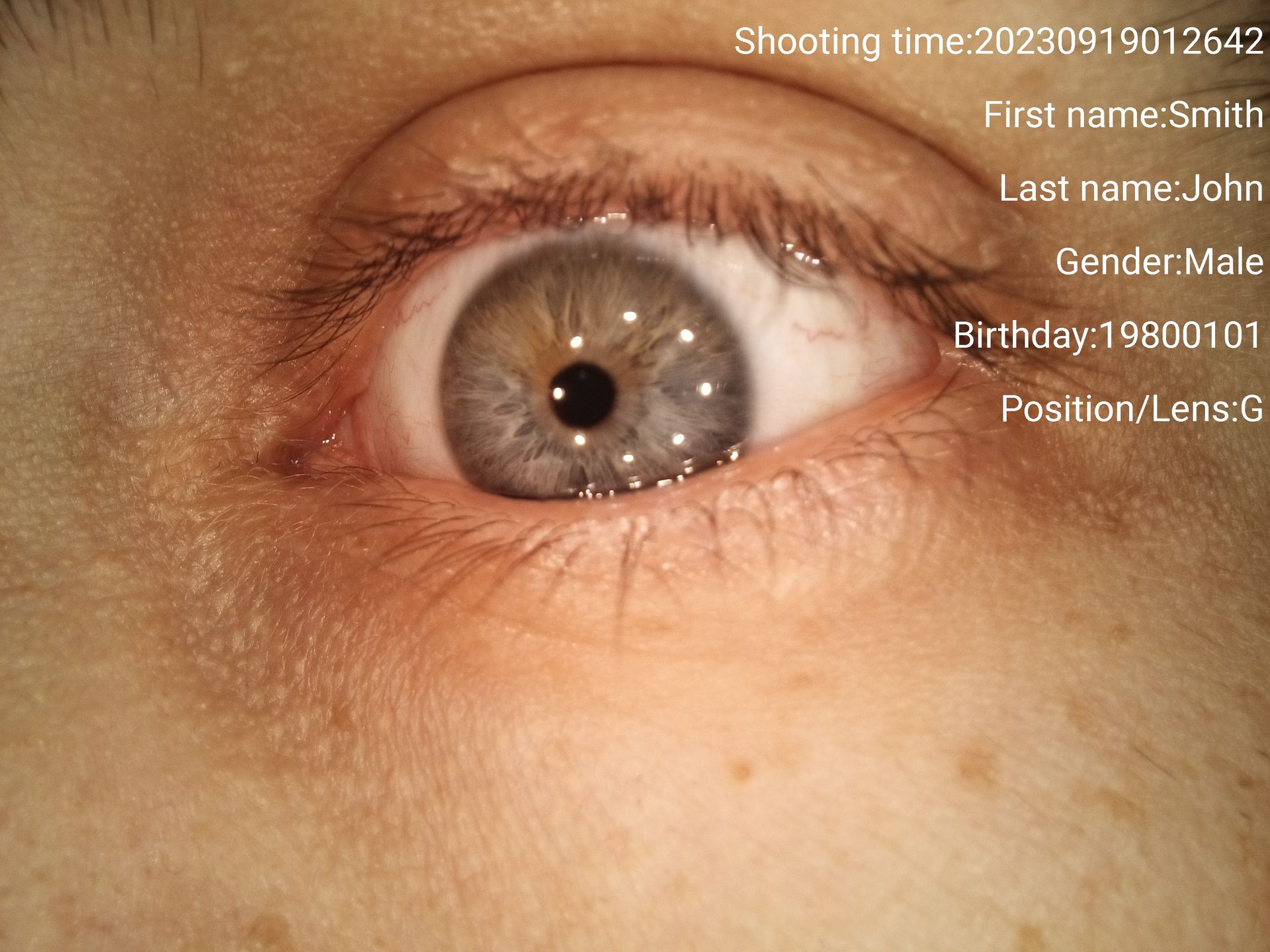 Riester RCS-100 | General Exam Camera